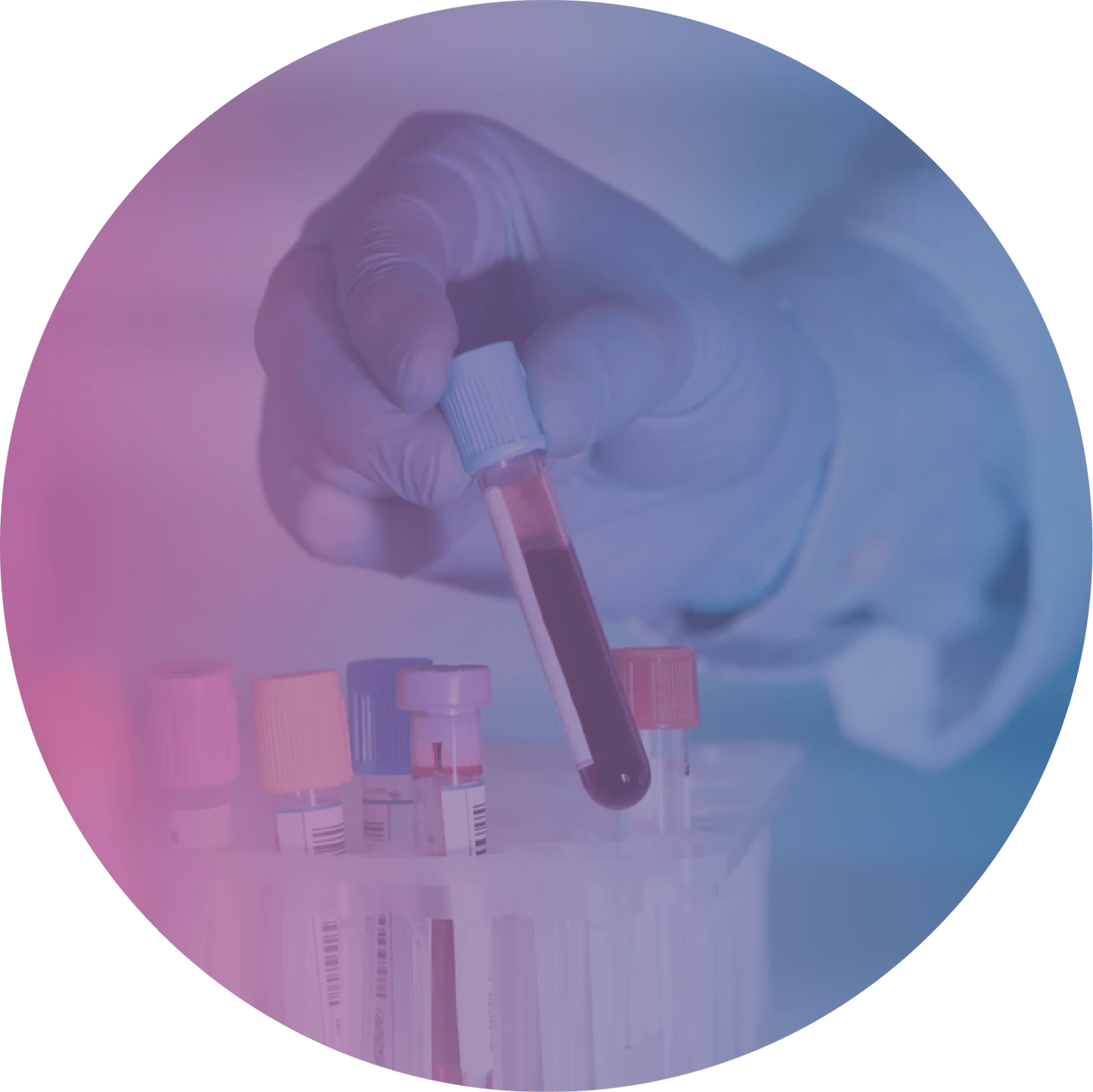 Bovine Serum Albumin | Biowest | Your best choice for animal serum